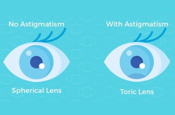 Torik Lens | Uğur Göz